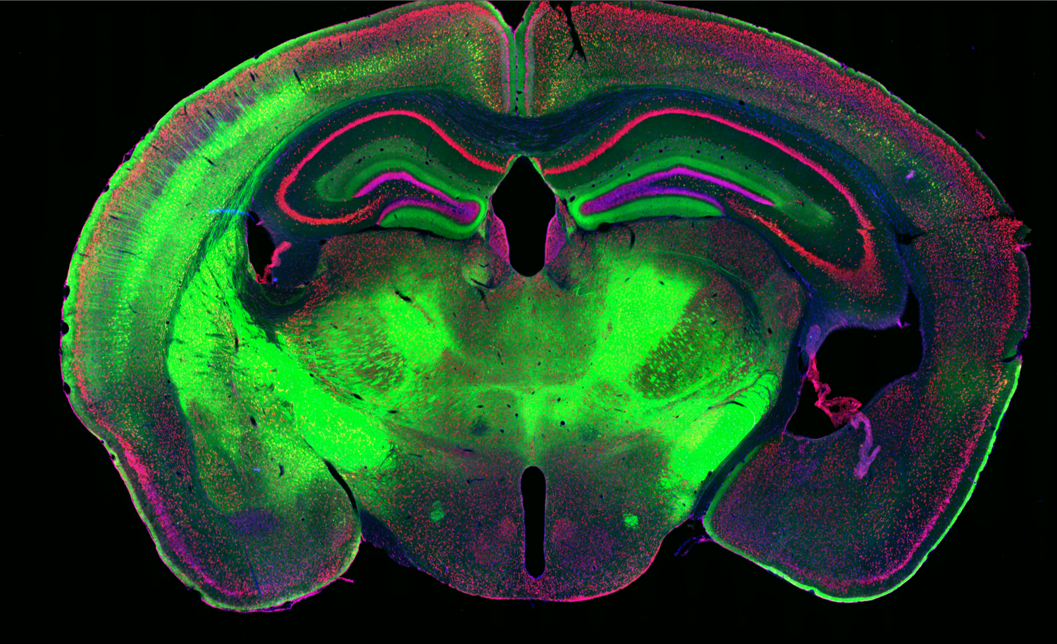 Research - Cell Biology | Emory School of Medicine